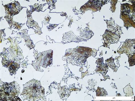 Microestructuras Con Perlita Y Ferrita