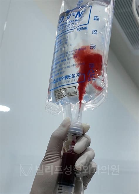 세포까지 젊어진다 혈액줄기세포주사에 대해 말씀드리겠습니다 네이버 블로그