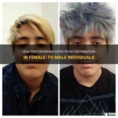 How Testosterone Affects Fat Distribution In Female To Male Individuals