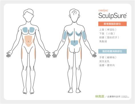 Sculpsure絲酷秀體外雷射溶脂俗稱酷熱雷射 突破減脂限制 雕塑曲線、減脂無死角 林亮辰皮膚專科診所 Bright Skin