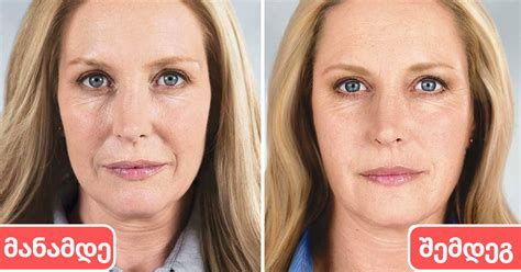 ვიზაჟისტმა მასწავლა როგორ შევნიღბო ცხვირტუჩის ნაოჭი მაკიაჟის გამოყენებით