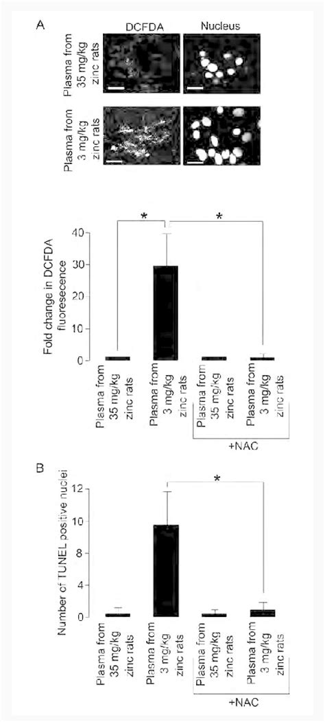 Plasma From Zinc Deficient Rats Induces Oxidative Stress In VSMCs A