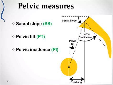 Importance Of The Sagittal Profile In Spinal Deformity Surgery Pptx