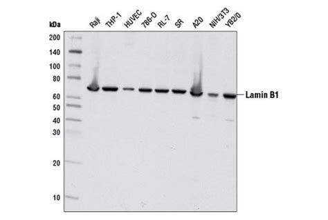 Lamin B1 Antibody Cell Signaling Technology