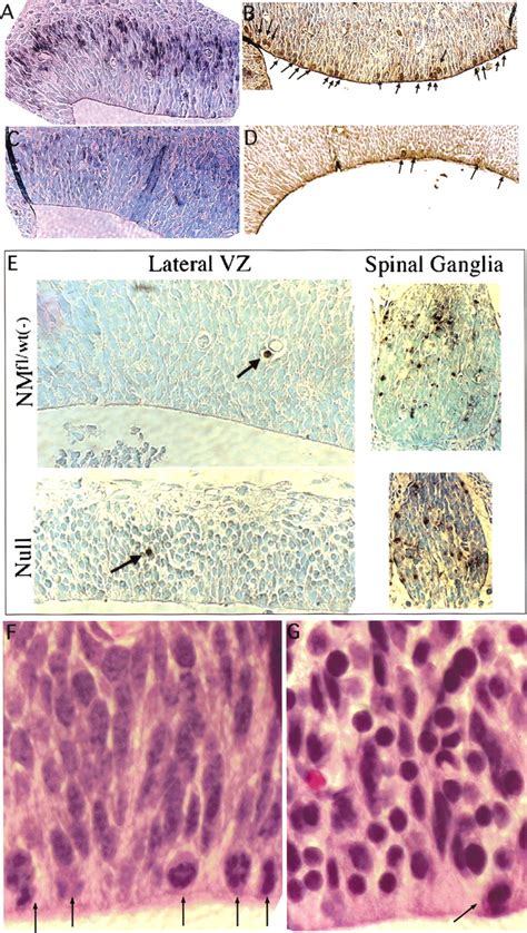 N Myc Is Essential During Neurogenesis For The Rapid Expansion Of