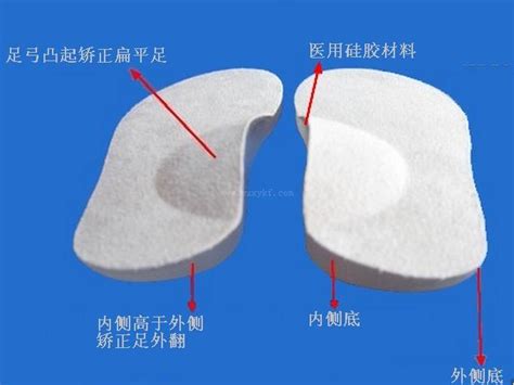 鹅足肌腱炎的康复