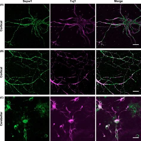 Selenoprotein W Sepw1 Is Expressed In Cell Bodies And Processes Of Download Scientific