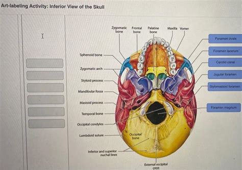 Solved Art Labeling Activity Inferior View Of The Skull