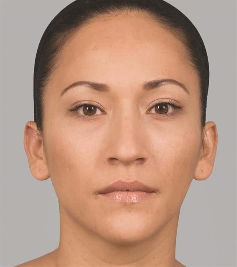 Botox And Fillers Find The Difference Between Botox And Fillers Red