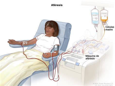 Trasplantes De Células Madre Y Médula ósea Para El Cáncer Nci