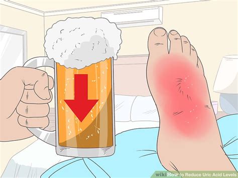 Easy Ways To Reduce Uric Acid Levels Wikihow Health