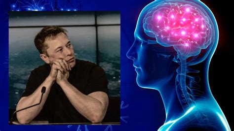 Neuralink D Elon Musk Obtient L Autorisation De Recruter Des Humains