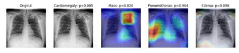 Tooba Shaukat On Linkedin Artificialintelligence Medicalimaging