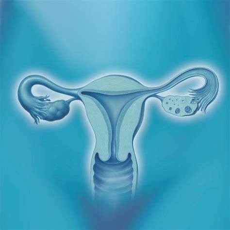 Comparison Of Intravenous Carbetocin And Intramuscular Oxytocin In Preventing Post Partum