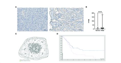 Protein Level Difference Of Grem1 In Pdac Based On Hpa Database A