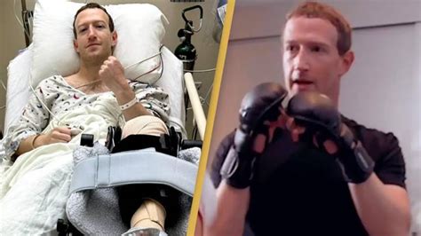 Facebooks Mark Zuckerberg Undergoes Surgery After Sustaining Injury