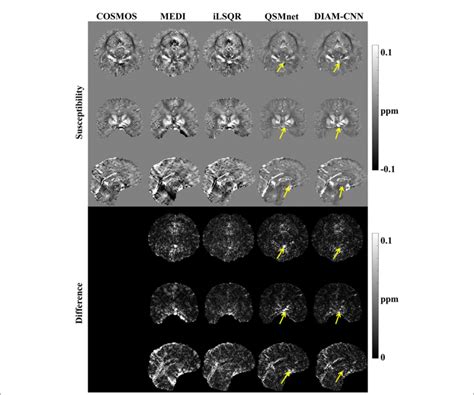 figure comparison of qsm of one subject reconstructed using the