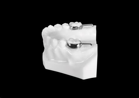 Distal Shoe Universal Orthodontic Lab