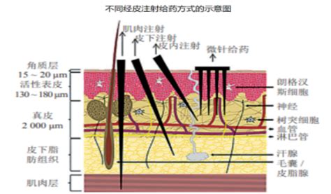 资料来源：《可溶性微针的研究进展》，奥咨达研究