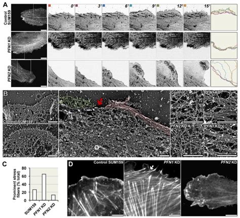Differential Remodeling Of Actin Cytoskeleton Architecture By Profilin Isoforms Leads To