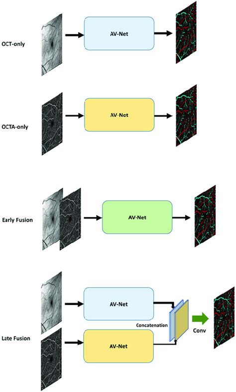 An Illustration Of The Mf Av Net Architectures Download Scientific