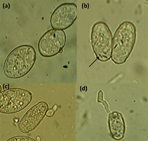 Morphological Features Of Anamorphic Stage On Podosphaera Xanthii A Download Scientific