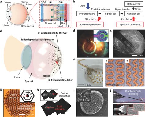 Bioinspired Visual Prosthesis A Structure Of The Eye And Retina