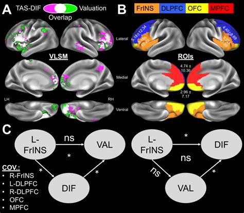 A Individual VLSM Results For The TAS DIF Scale And The Reward