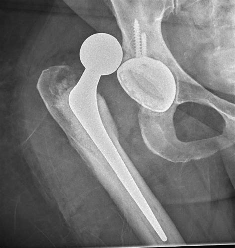 Background The Bone School