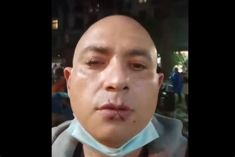 ბექა გრიგორიადისმა პირი და თვალი ამოიკერა ვიდეო Marshalpress