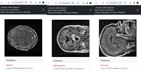 Figure 13 From A Novel Ensemble Framework For Multi Classification Of Brain Tumors Using