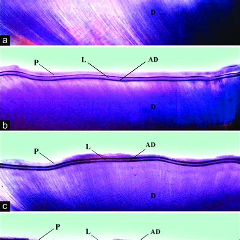 Photomicrographs Of Sections Of Artificial Root Lesion A Gse B Download Scientific Diagram