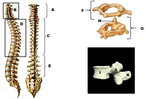 Solved 1 Spinous Process 2 Lumbar