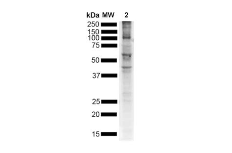 Anti Alpha Synuclein Phospho S129 Antibody [j18] A304933
