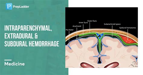 Subdural Hemorrhage Vs Subarachnoid Hemorrhage