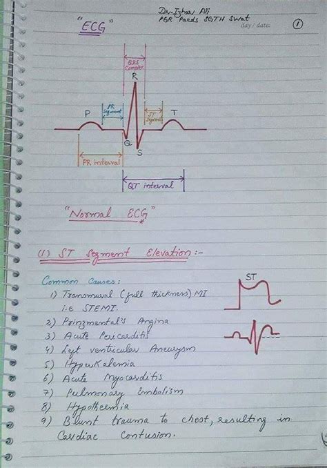 SOLUTION Ecg Notes Studypool