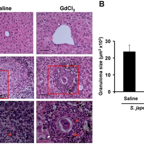Repeated Injection Of Gdcl3 Attenuates S Japonicum Egg Induced Hepatic
