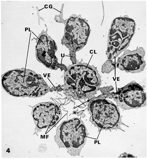 Peripheral Lymphocytes Pl Some With Slender Uropods U And One