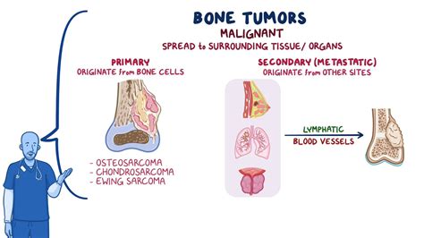 Bone Tumors Nursing Osmosis Video Library