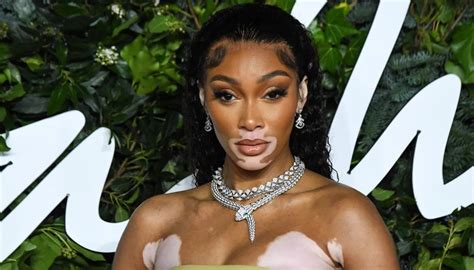 50 Facts About Winnie Harlow