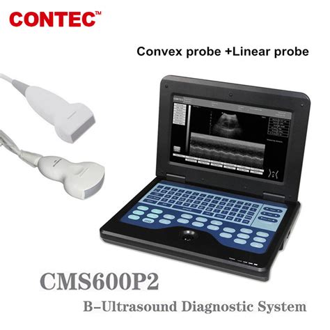 Cms600p2 Portable Laptop Machine Digital Ultrasound Scanner75m Linea