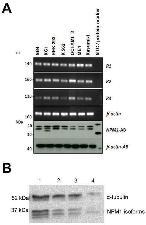 A Conventional Pcr And Western Blot Analysis Of Npm1 Isoforms In Cell