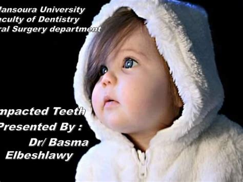 31 Embedded And Impacted Teeth Pptx