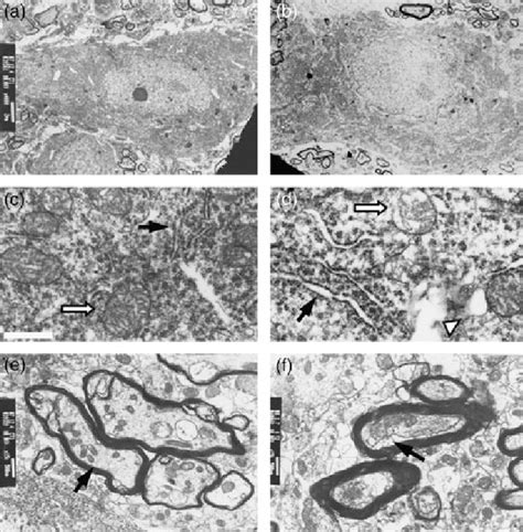 Electron Micrographs Of The Ultrastructural Characteristics Of The