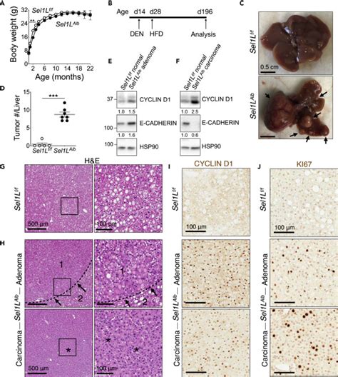 Sel1l Hrd1 Er Associated Degradation Suppresses Hepatocyte Hyperproliferation And Liver Cancer
