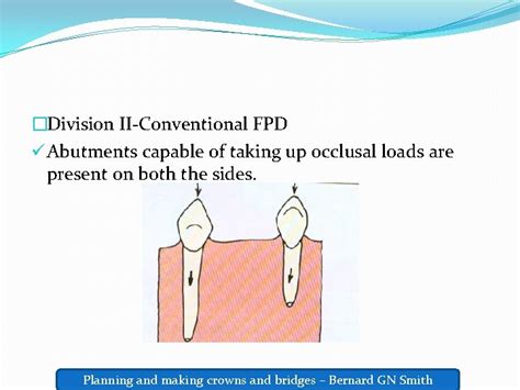 General Considerations Components And Classification Of Fpd Christeena