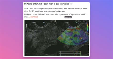 Endocollab™ Gi Endoscopy Education On Linkedin Patterns Of Luminal