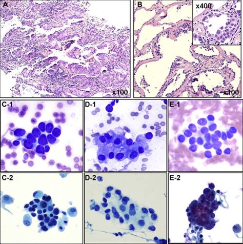 What Is A Biopsy A Biopsy Is An Example Of Tissue Taken… By