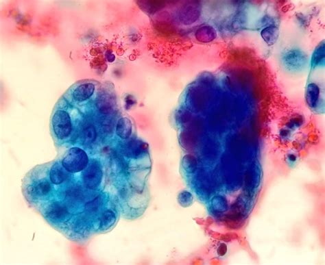 Bryant Bell Mscct Ascpdhsc On Linkedin Héctor Enrique Torres