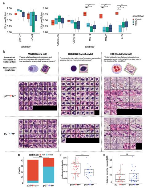 Evaluation Of The Annotation Accuracy Of Segpath A Annotation